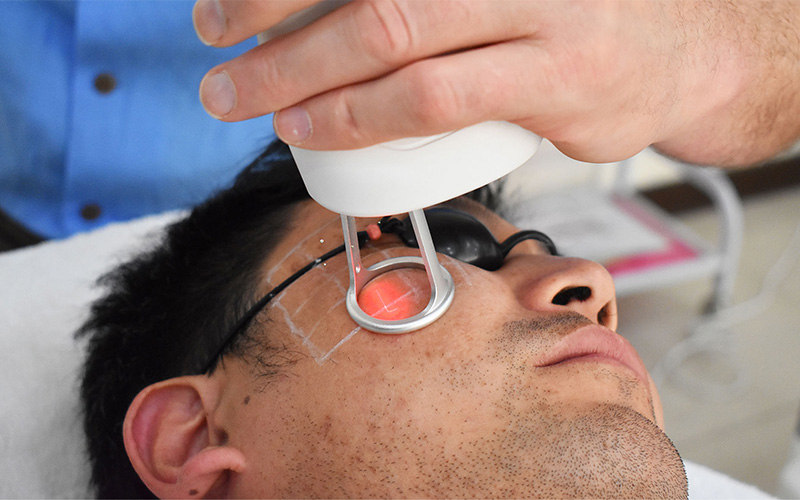 What is the use of 1550nm fiber erbium laser - Apolomed